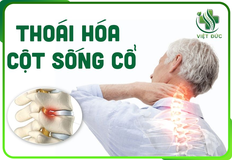 Thoái hóa cột sống lưng - Phòng khám Việt Đức